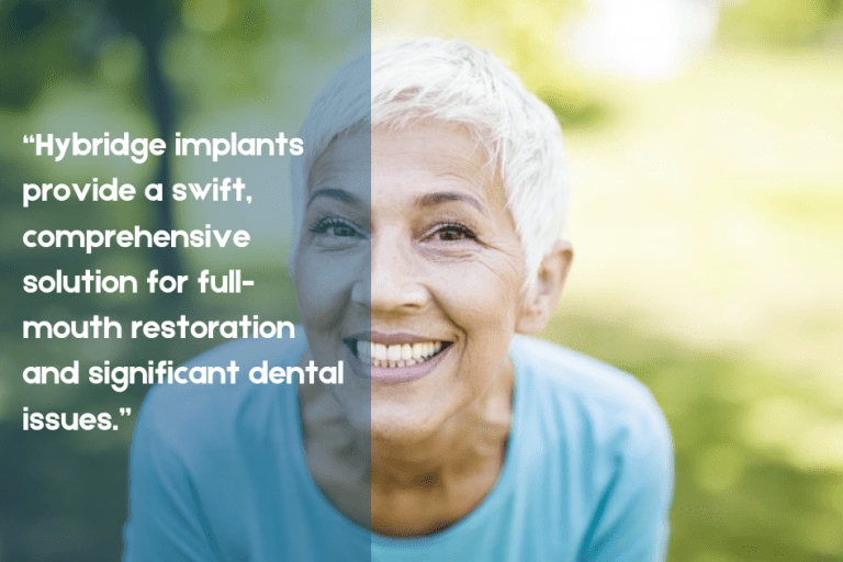 Comparing Hybridge Implants to Traditional Dental Implants: What's the ...